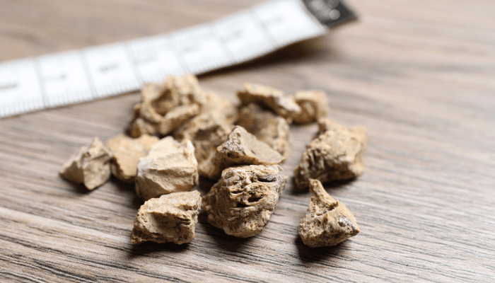 What are the Different Types of Gallstones?