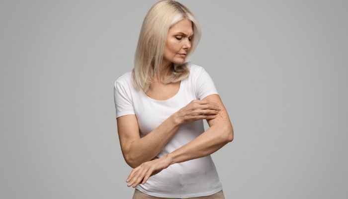 Menopause Itching: Causes, Treatments, and Prevention Tips