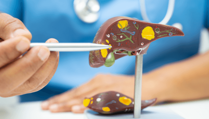 What are the Different Types of Gallstones?