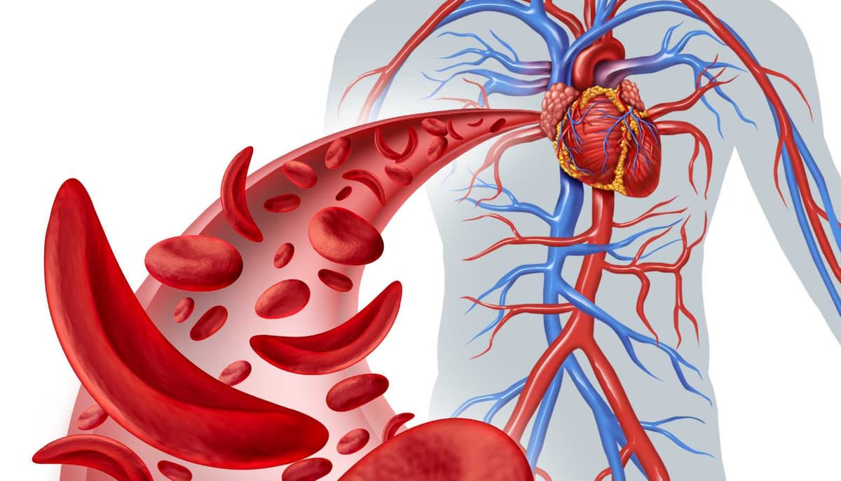 How To Tell If You Have Poor Circulation: Signs, Causes & Remedies ...